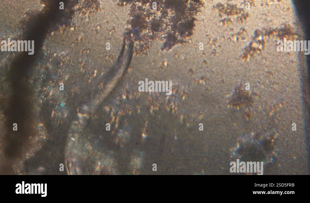 Microscopy of parasite worm nematode (Strongyloides stercoralis). Movement of ac Stock Video ...