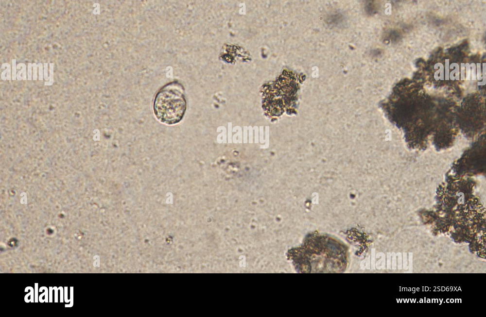 Microscopy of protozoa ciliate and small microorganisms in the water ...
