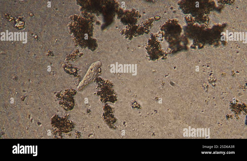Microscopy of Amoeba limax in the water sample. Magnification 300x ...