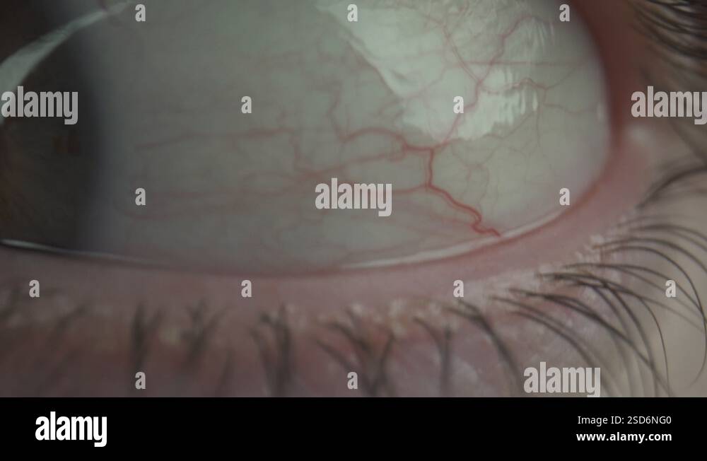Scary Anxious macro closeup of human eye and eyeball Stock Video ...