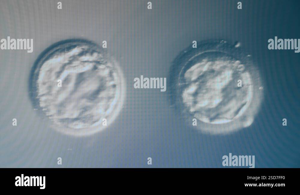 In Vitro Fertilisation concept. Cells under a medical microscope in ...