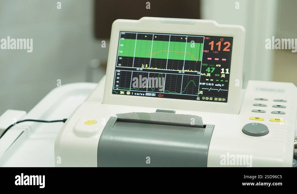 EKG monitor Cardiograph. Cardiograph display during the measurement of ...