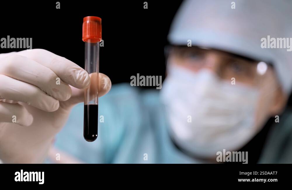 Close up Medical doctor performs a blood test. The technician holds a ...