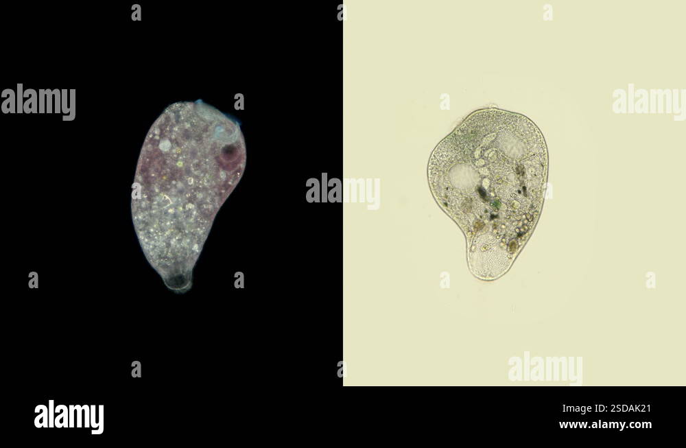 Infusoria Stentor under the microscope, the family Stentoridae, class ...