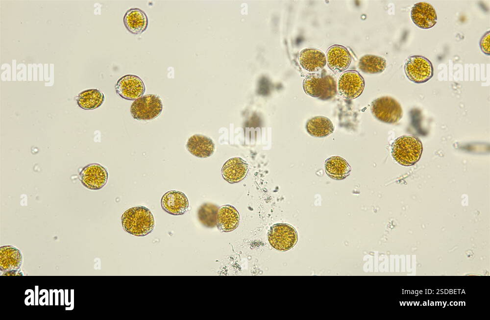 phytoplankton of the Black Sea, a colony of algae Dinoflagellata Stock ...