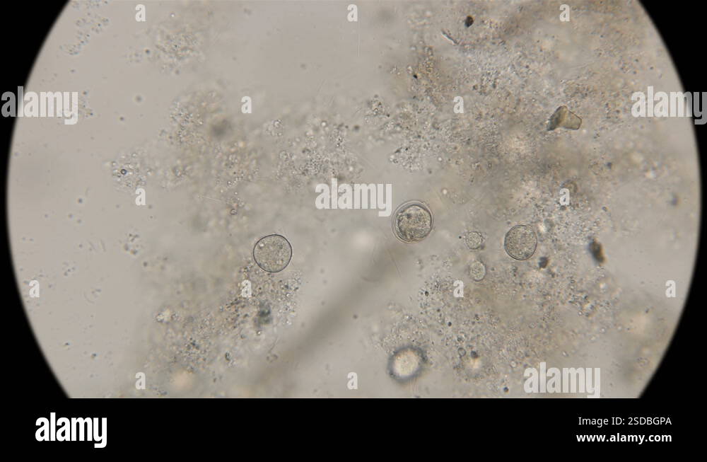 cysts, an egg of an unknown microorganism, under a microscope Stock ...