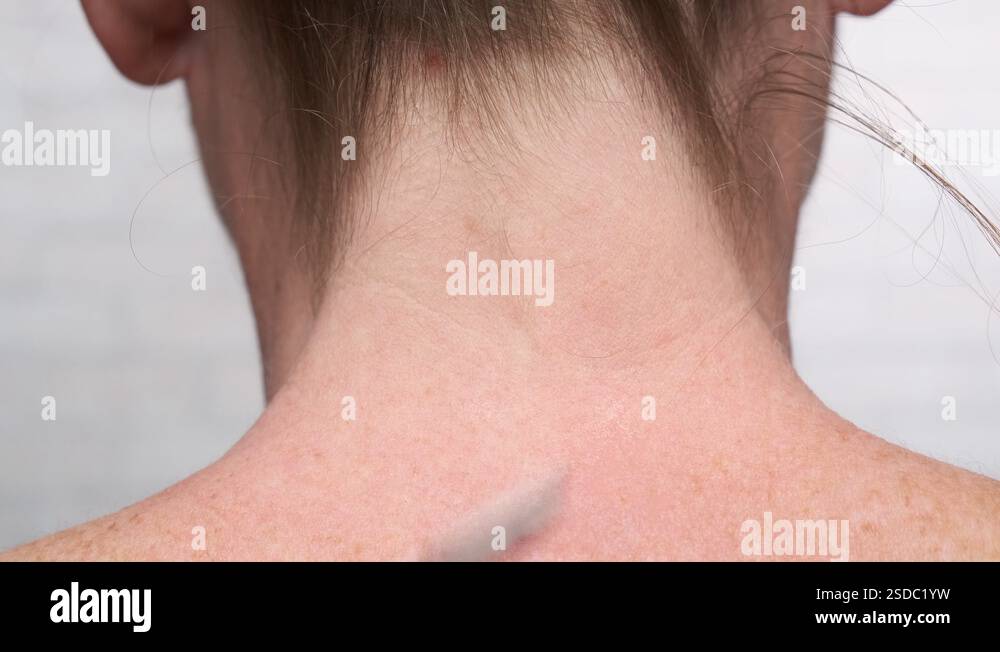 Microchipping man. Micro chip is implanted on neck of person Stock ...