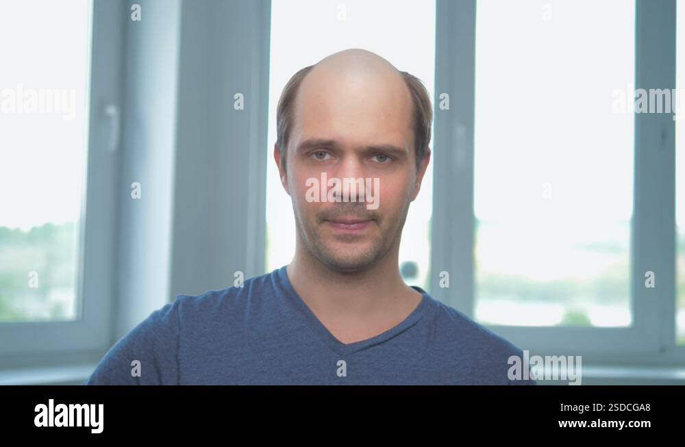 a balding man puts on a wig with small curls and smiles Stock Video ...