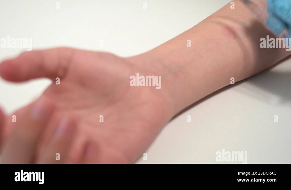 Nurse applying transparent ruler to check reaction of Mantoux test ...
