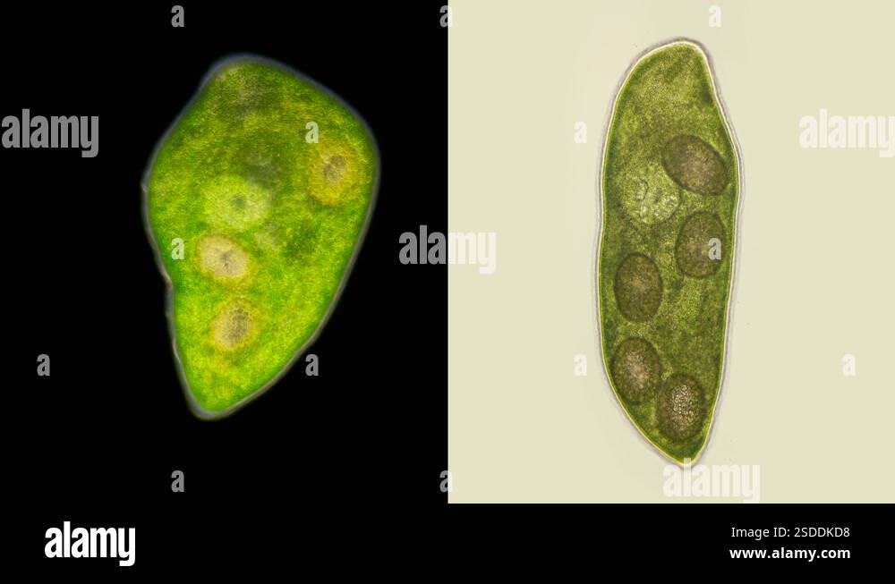 Flatworm Typhloplana sp. under a microscope, the Typhloplanidae family ...
