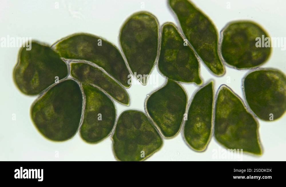 Flatworm Typhloplana sp. under a microscope, the Typhloplanidae family ...