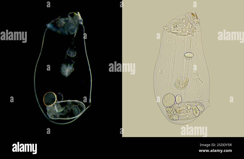 Rotifer under the microscope Asplanchna priodonta, family Asplanchnidae ...