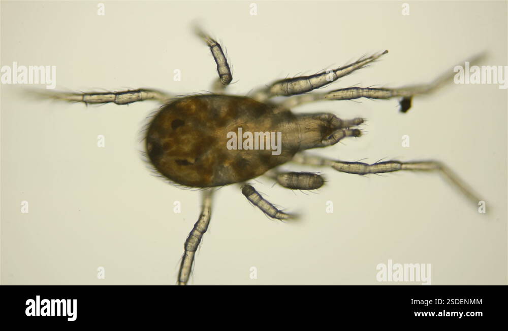 Acari(mite) under a microscope, order of the Mesostigmata, Arachnida ...