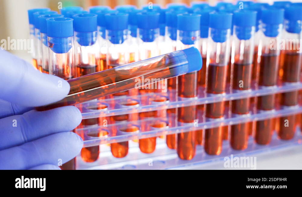 A blood sample inside the test tube kit in the lab Stock Video Footage ...