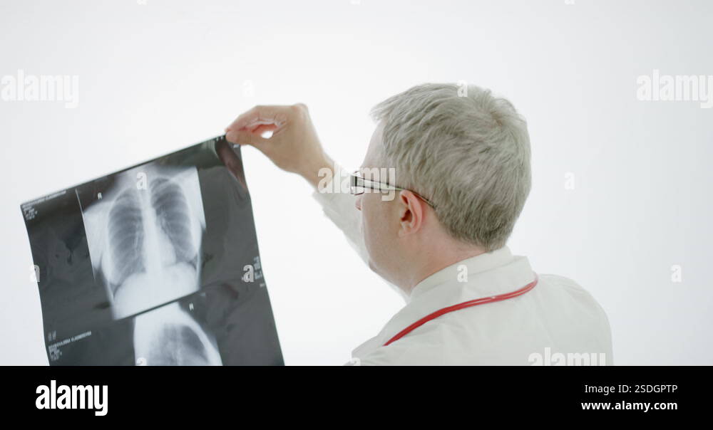 Doctor examines chest x-ray shot on a film viewer, 6K shot on Red Stock ...