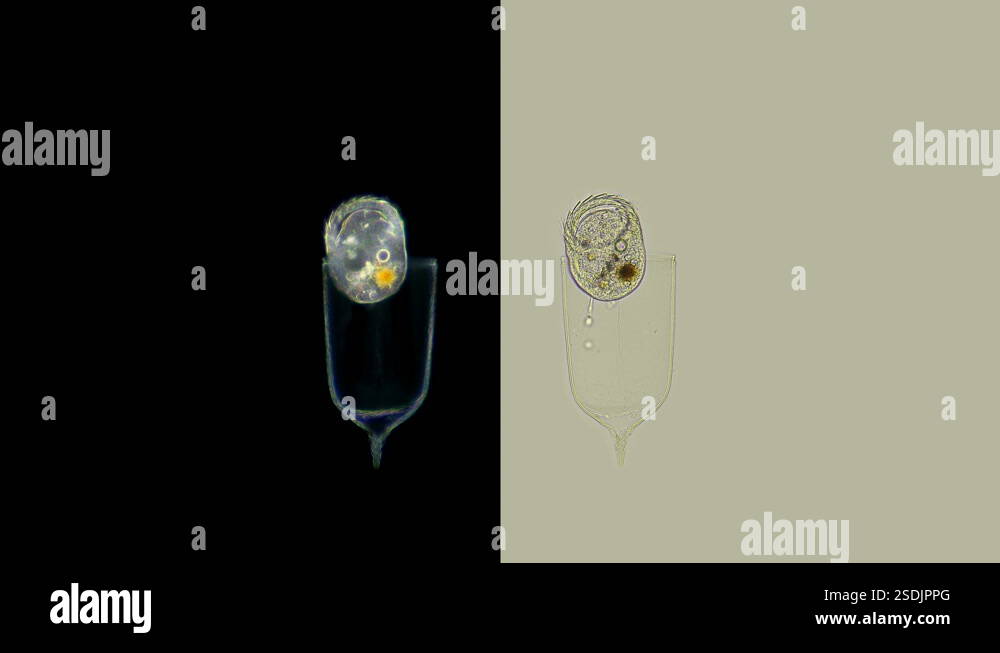 ciliates Tintinnida Favella sp. under the microscope, suborder ...