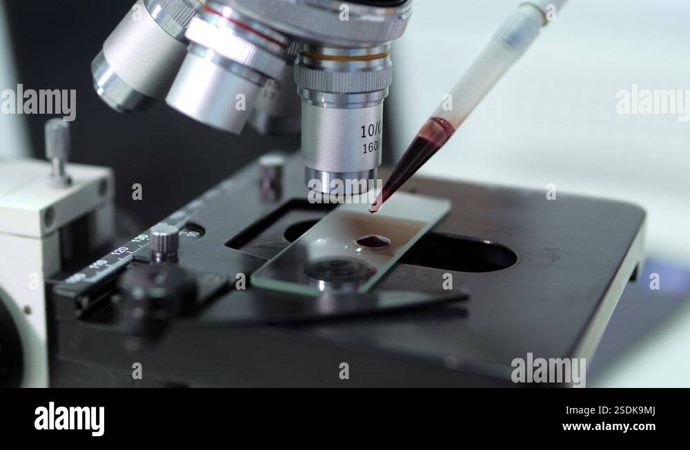 Microbiologist is testing a sample of blood contaminated by Coronavirus ...