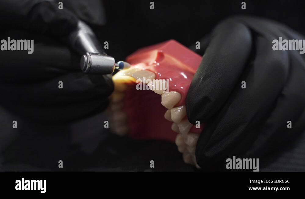 Dental composite Polishing Demonstration with Grinding Drill - Eye ...