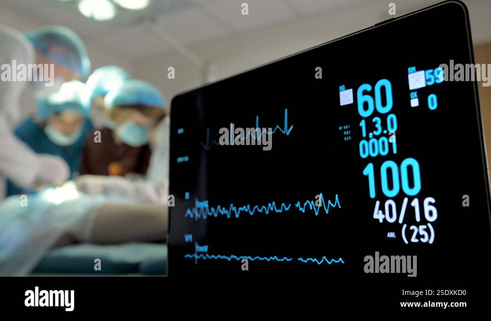 Monitoring of ECG and saturation O2 in the patient in the operating ...