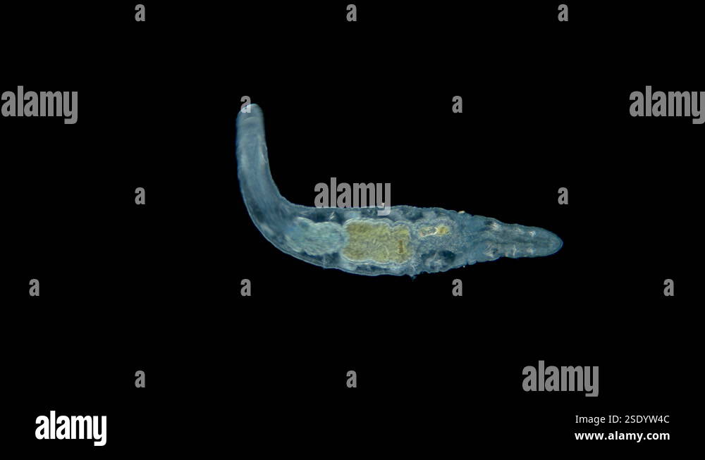 Oligochaeta Chaetogaster sp. under the microscope, family Tubificidae ...
