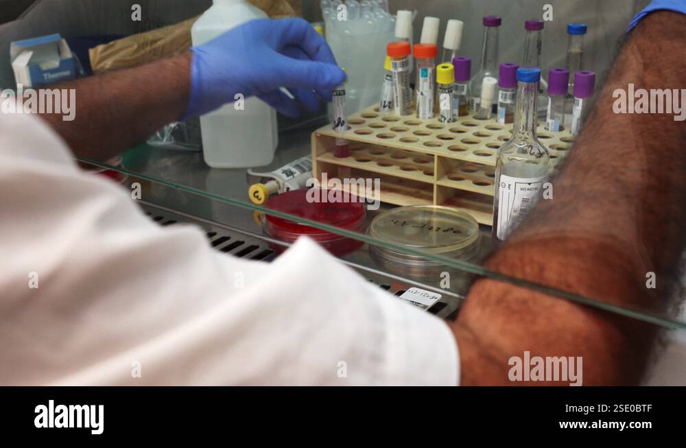 Viewing a computer screen of the results of a bacterial test in the ...