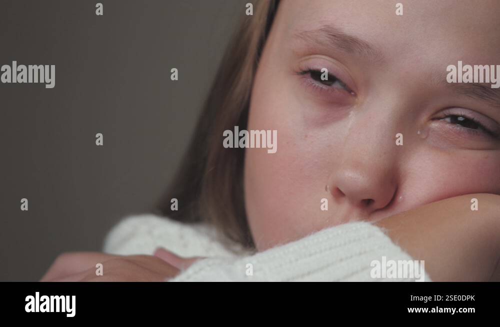 Tears roll down the cheeks on the child's face. Upset teenager crying over Stock Video Footage ...