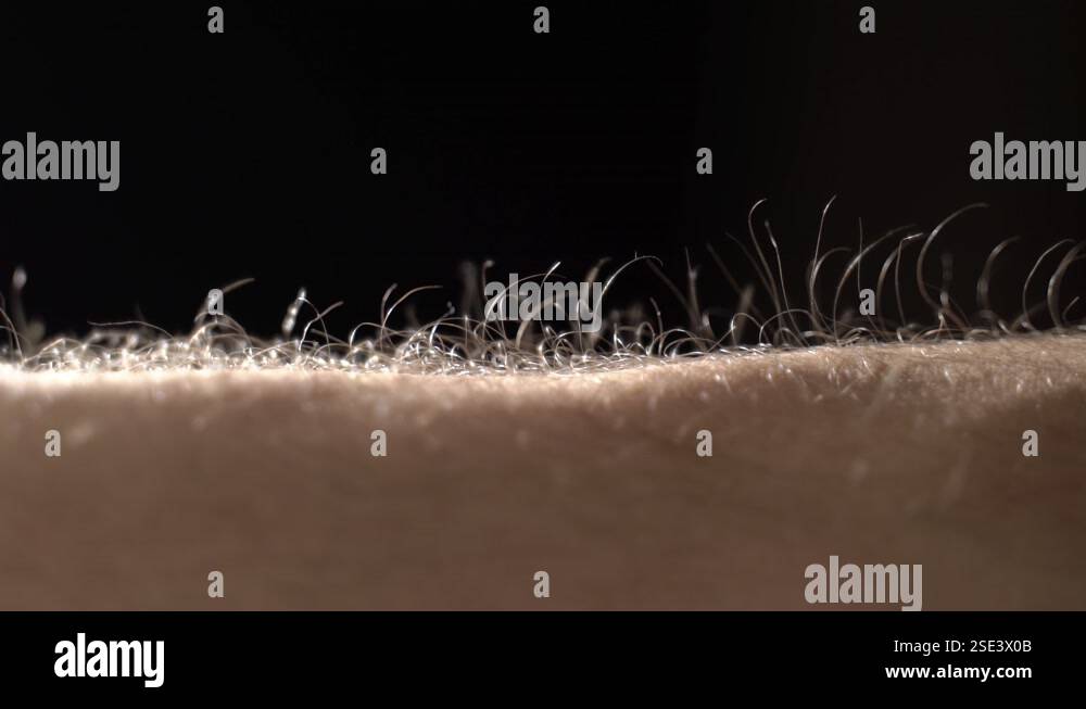 Goosebumps close up. Hair on his hand stand up. Static electricity ...