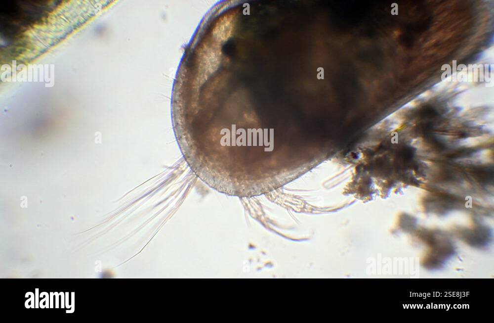 Microscopic crustacea Stock Videos & Footage - HD and 4K Video Clips ...