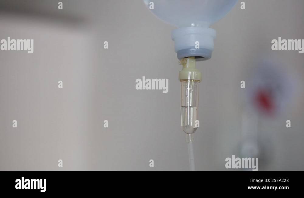 Saline drop in a drip chamber being infused along with medicine, and ...
