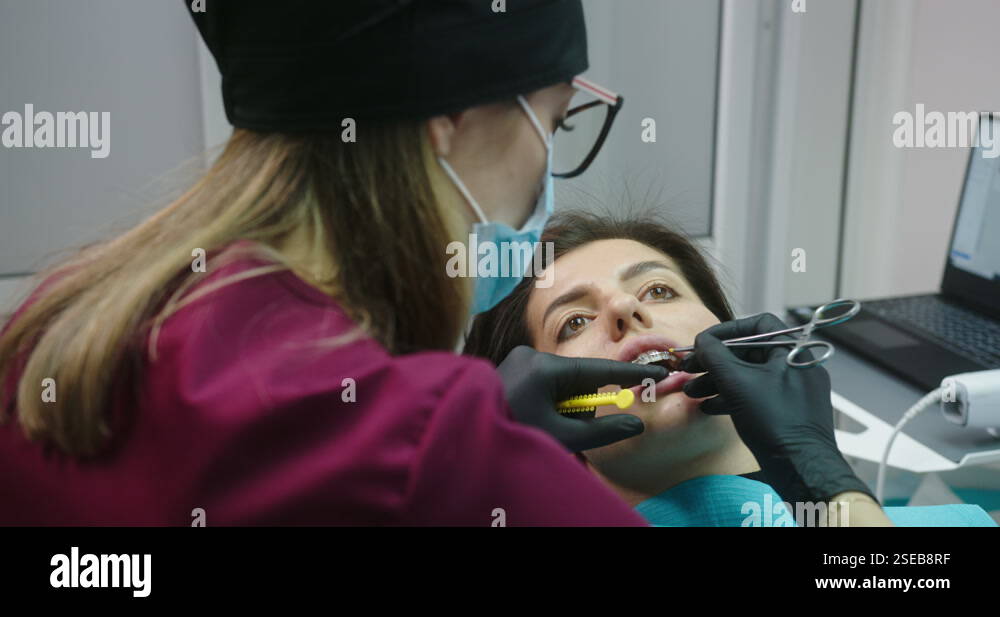 The process of putting on colored rubber bands for braces ligatures ...