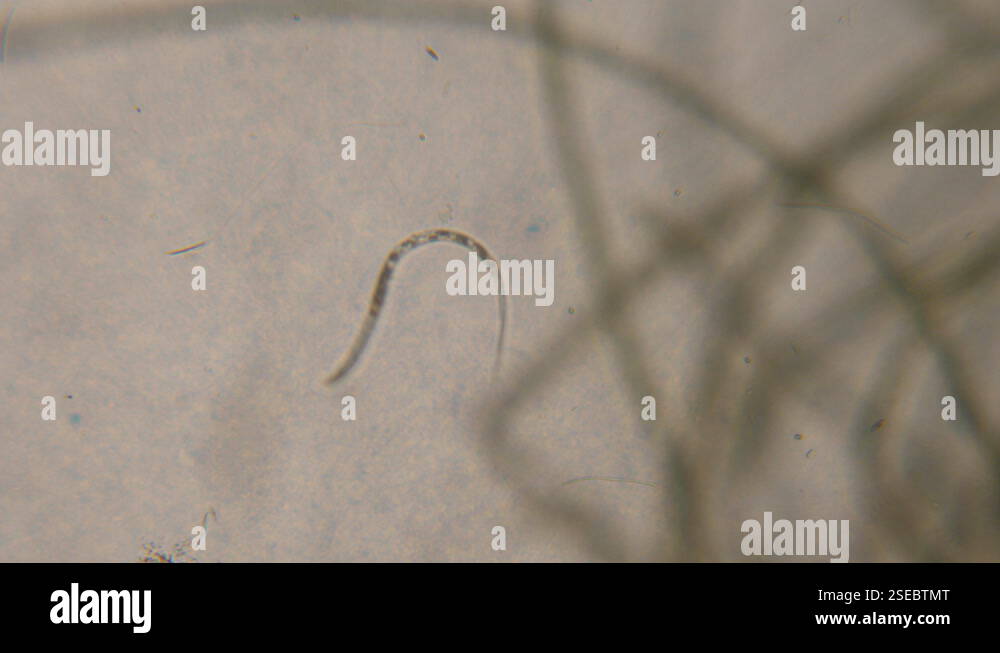 Bacteria Parasites and Worms in drinking Water under Microscope ...