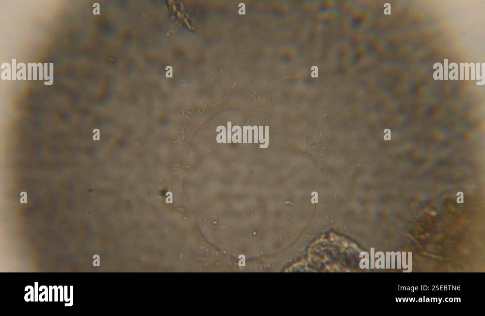 Bacteria Parasites and Worms in drinking Water under Microscope ...
