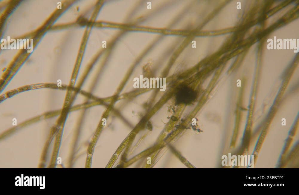 Chloroplast Under a Microscope Dead Plant. Cell Division. Dead Plant ...