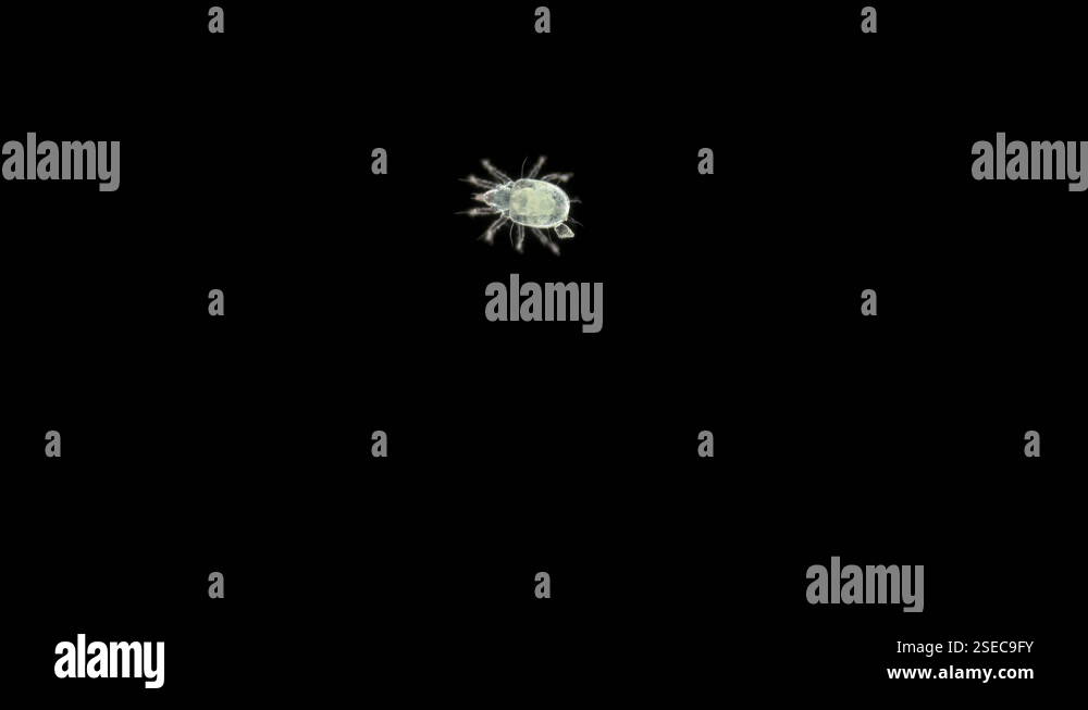 Soil mite of the Acaridae family under a microscope Stock Video Footage ...
