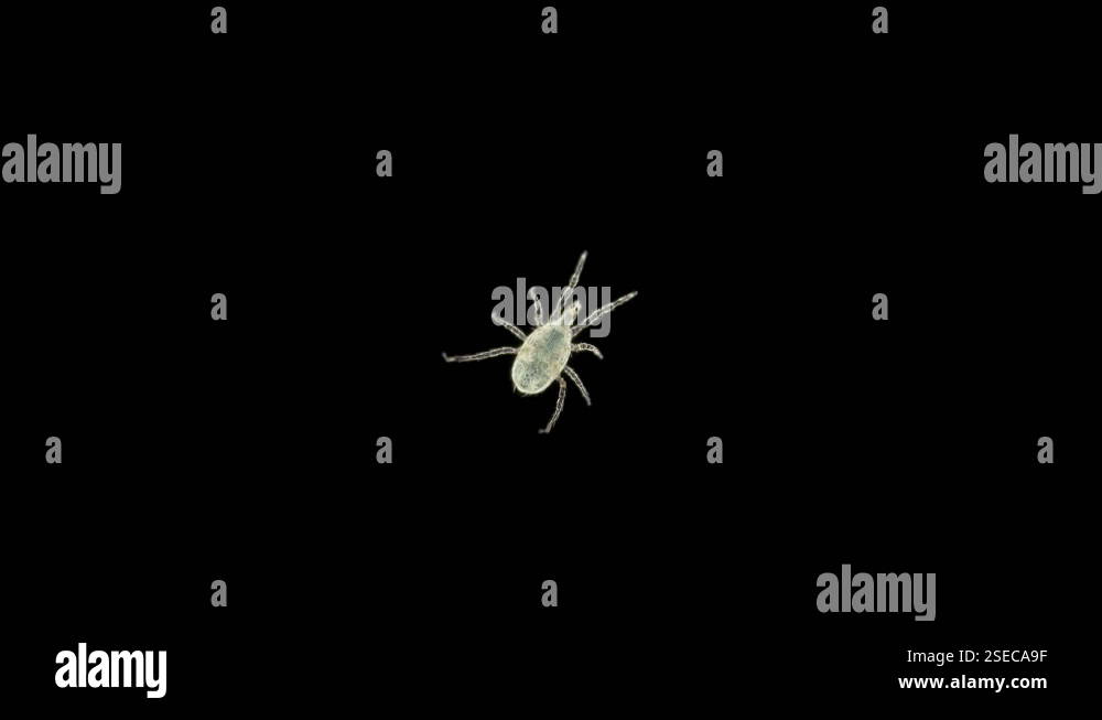 Tick of order Mesostigmata under a microscope, possibly of the family ...