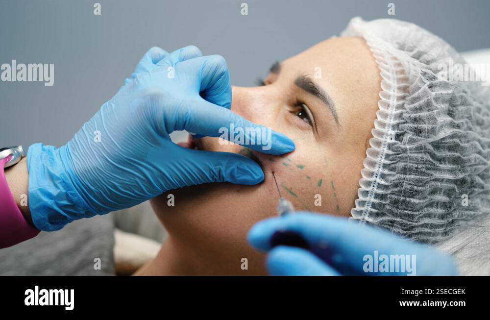Beautician makes injections on the face of a young woman client in the ...