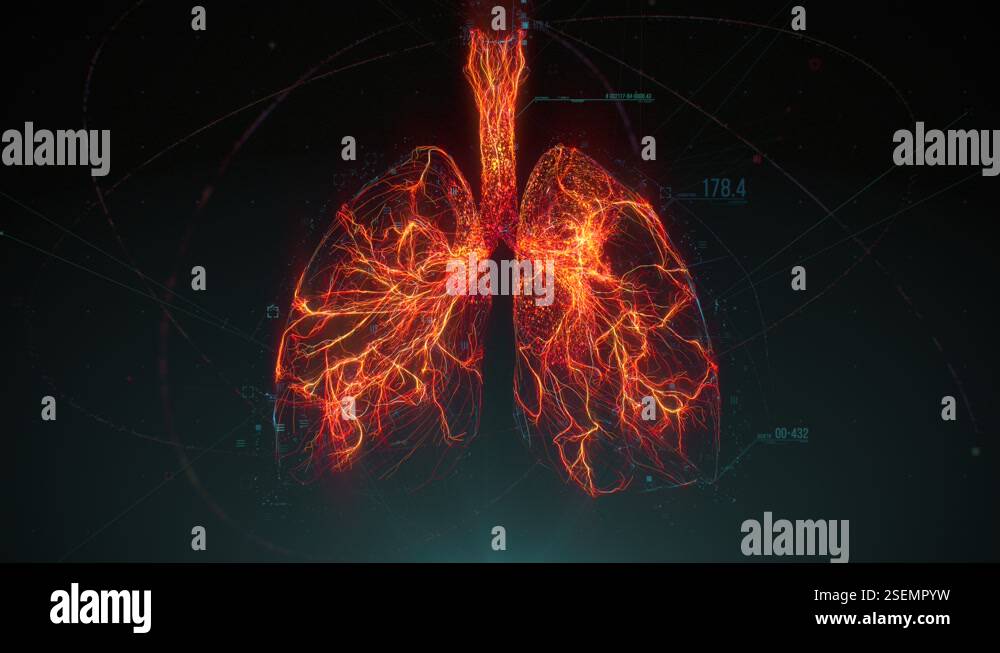 Respiratory system infection. Lung inflammation. Pneumonia Stock Video ...