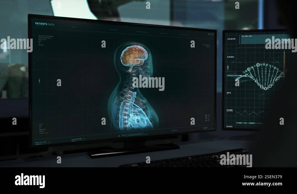 Doctors Medical Software Creates X-Ray Model Of Patients Body For ...