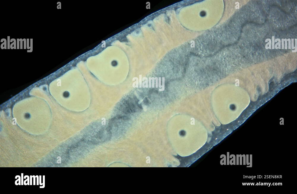 Worm Nemertea Prostoma sp. under the microscope, of the ...
