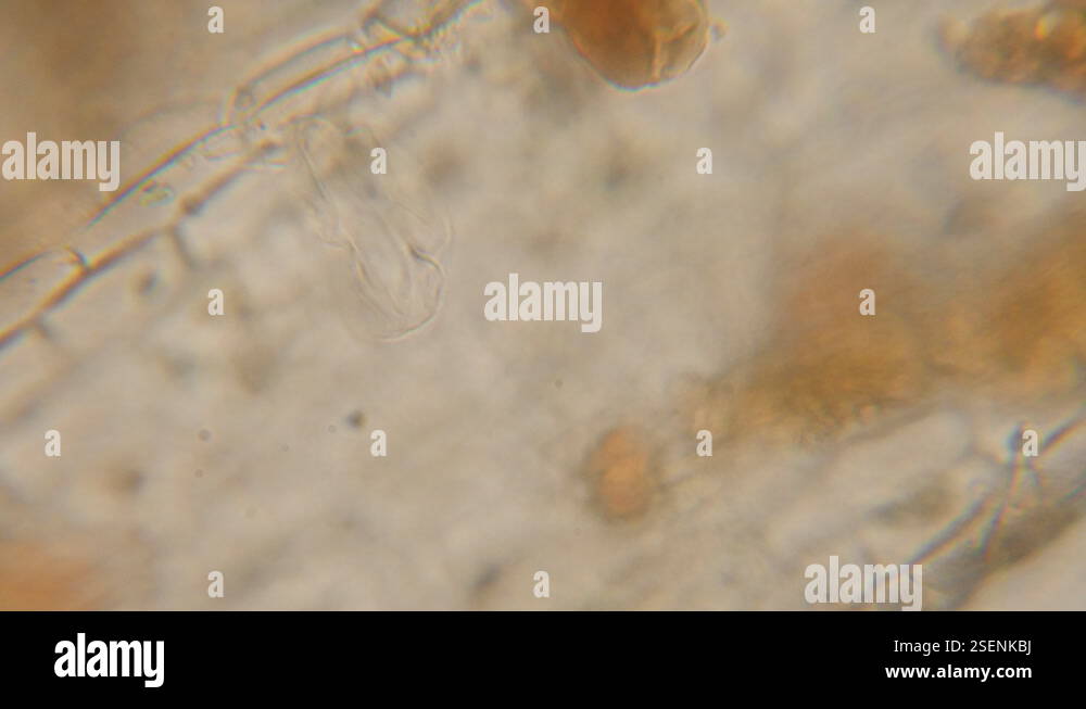 Chloroplast Under a Microscope Dead Plant. Cell Division. Dead Plant ...