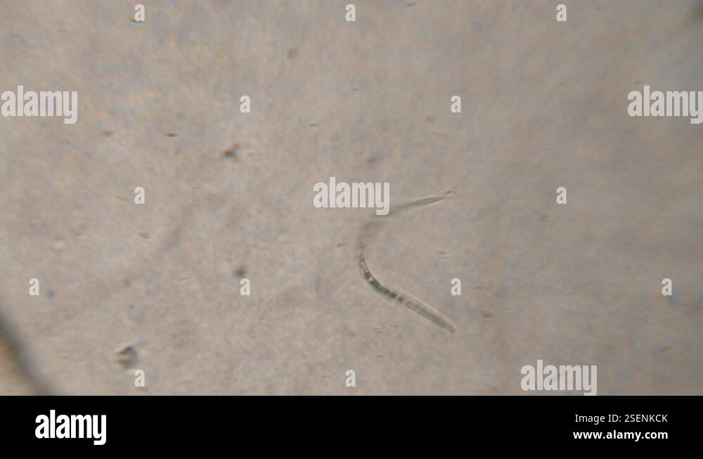 Bacteria Parasites and Worms in drinking Water under Microscope ...