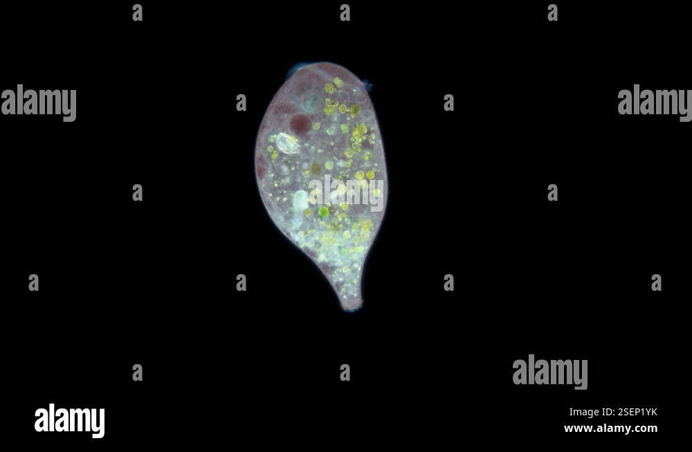 Stentor Ciliophora Infusoria under microscope, family Stentoridae ...