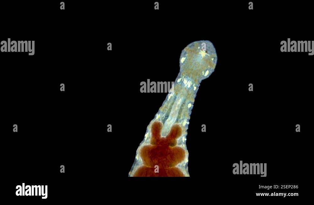 Leech of the family Glossiphoniidae under a microscope, order ...