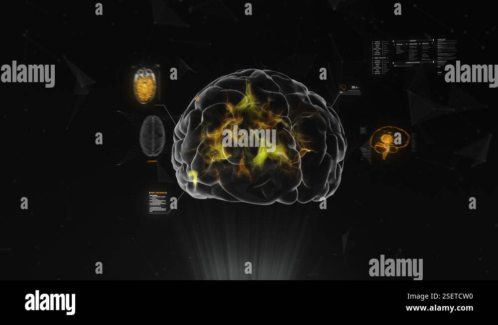 Rotating Brain with Several Animations Appearing. Medical Interface ...