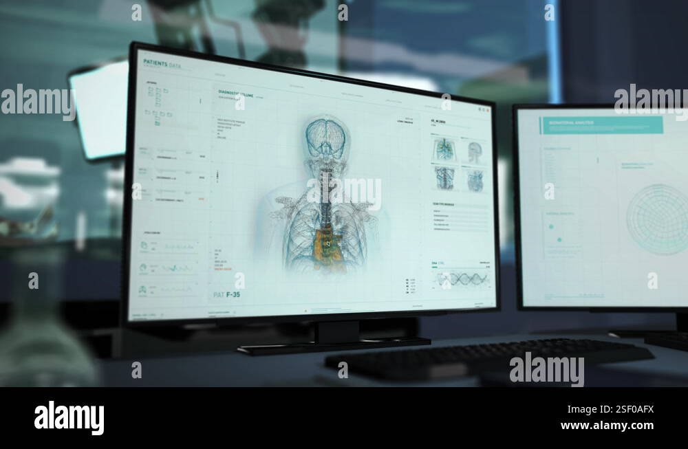 Medical Monitoring Of Brain Health Concludes With Tumor Illness ...