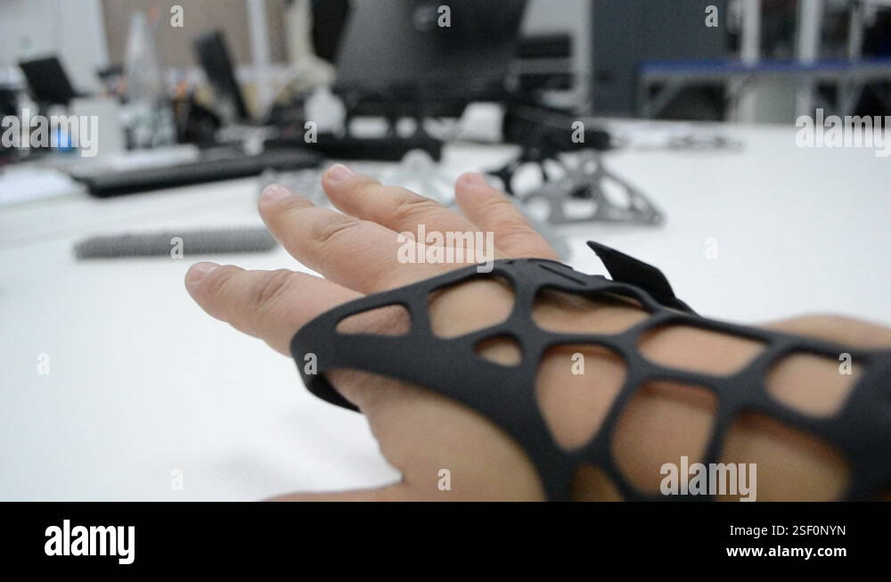 Black orthopedic plastic prosthesis printed on powder 3D printer on ...