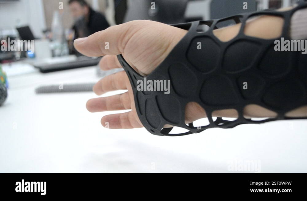 Black orthopedic plastic prosthesis printed on powder 3D printer on ...