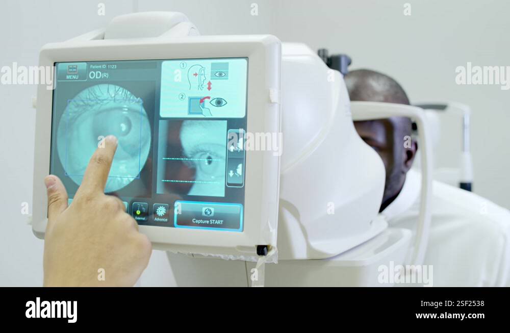 A retinal exam was performed on a man using an optical coherence ...