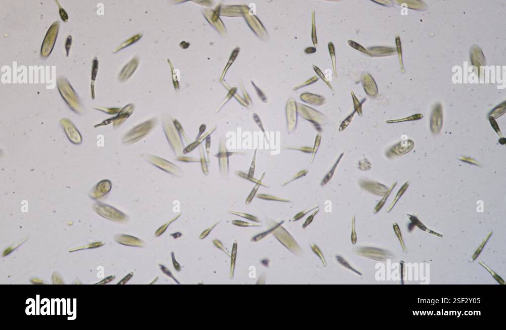 Protozoa single cell organisms in microscope bright field Stock Video ...