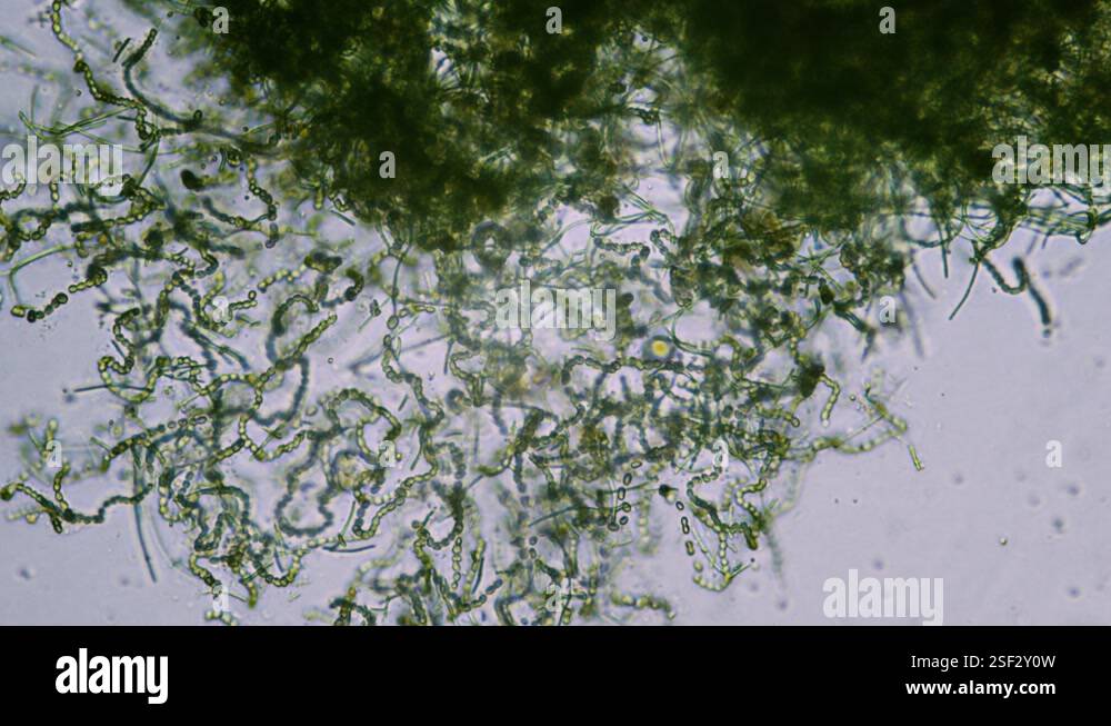 Green algae cells in microscope bright field Stock Video Footage - Alamy